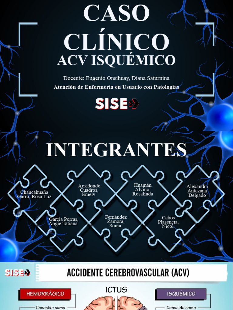 Acv Isquemico 2 | PDF | Carrera | Isquemia