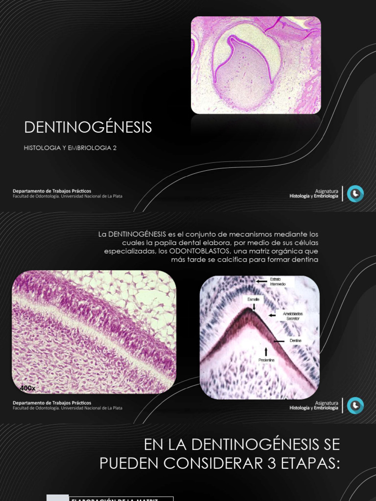 04 - Dentinogenesis y Amelogénesis | Descargar gratis PDF | Dentina ...