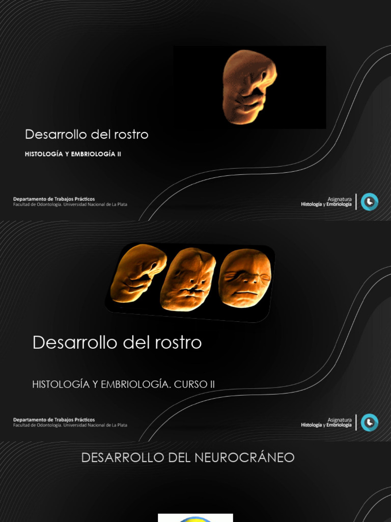 02 Formacion Del Rostro Pdf Cráneo Lengua