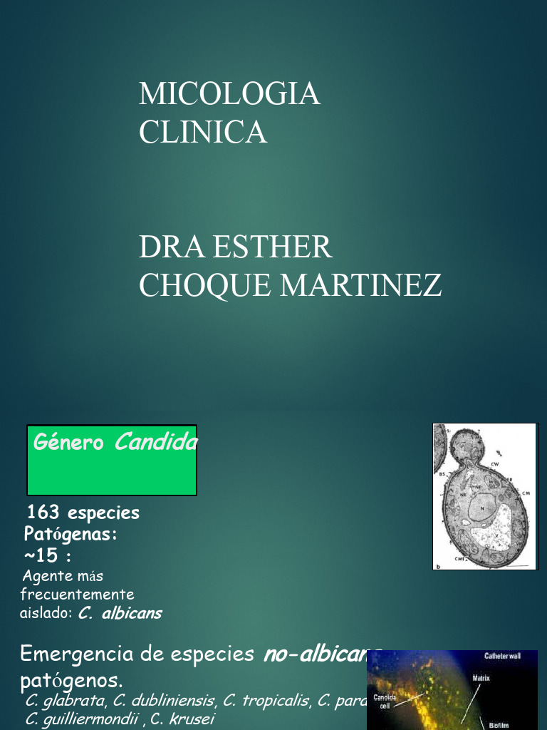 Candidiasis: Tipos, Diagnóstico y Tratamiento | PDF | Candidiasis ...