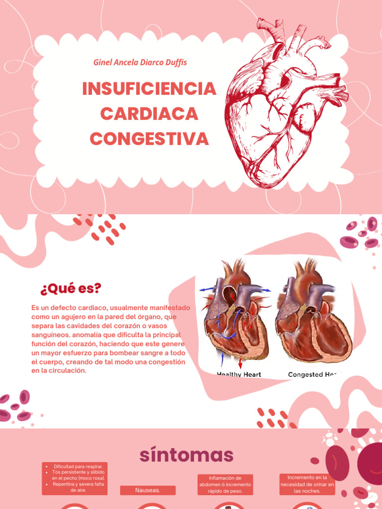 Insuficiencia Cardiaca Congestiva | PDF | Corazón | Insuficiencia cardíaca