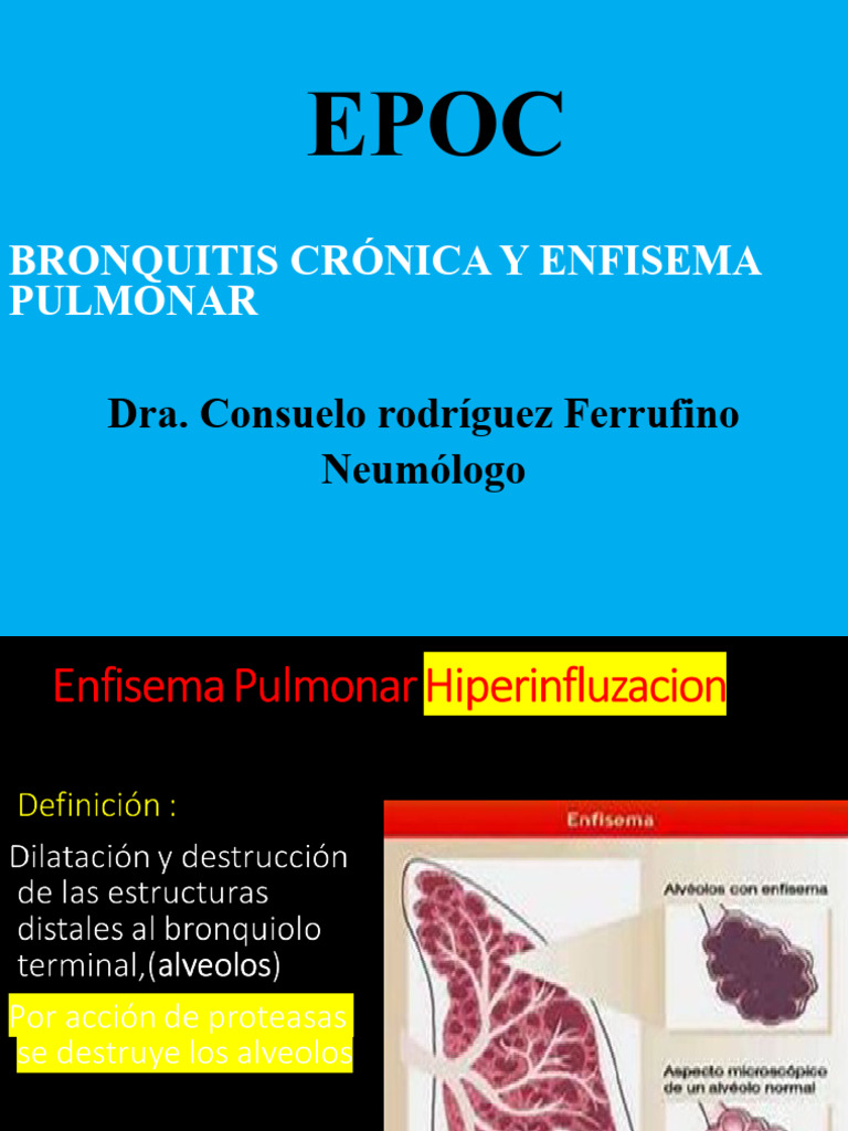 EPOC | PDF | Enfermedad pulmonar obstructiva crónica | Tos