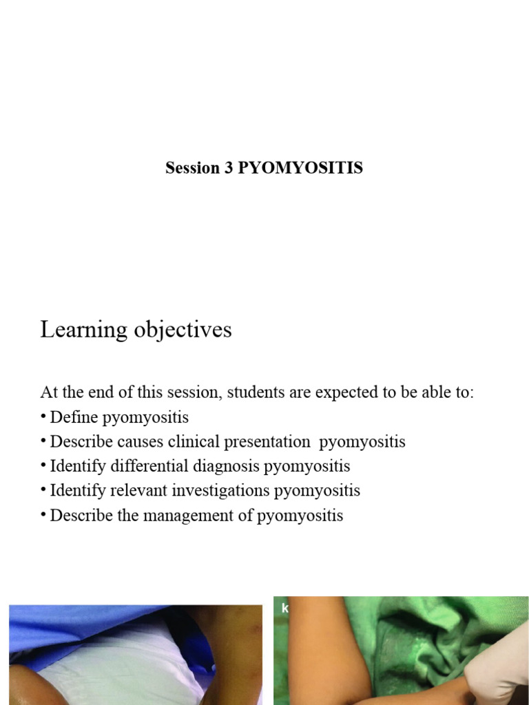 Causes of Pyomyositis Explained | PDF | Infection | Muscle
