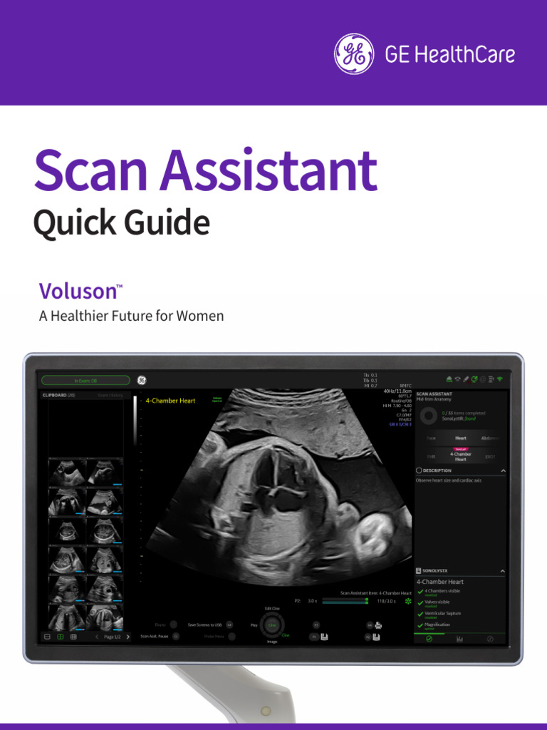 2024 Voluson Scan Assistant Quick Guide jb25556xx | PDF | Computer Keyboard | Computer Science