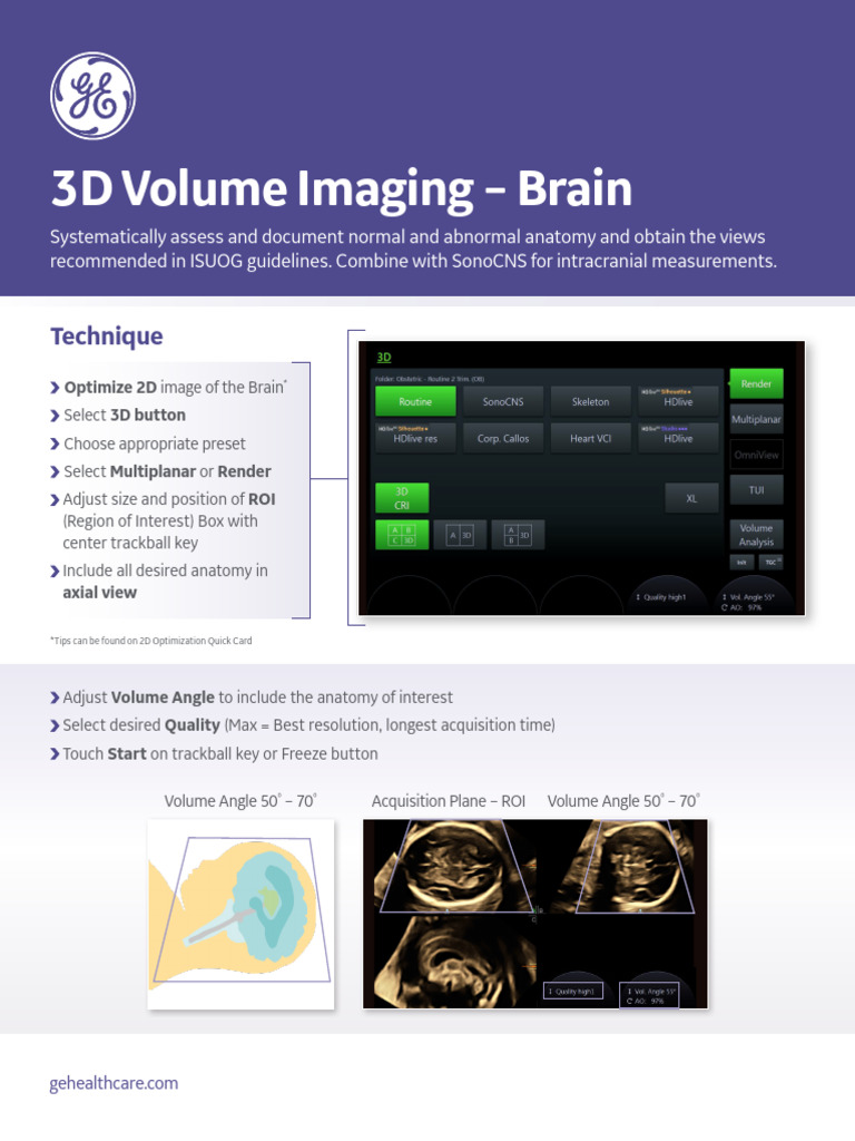 3d Volume Brain Quick Card Voluson 2020 | Download Free PDF | Imaging 3d Volume Brain Quick Card Voluson 2020 | Download Free PDF | Imaging