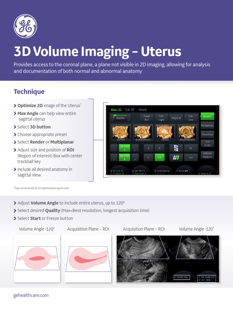 3d Uterus Quick Card Voluson 2020 | PDF | Imaging