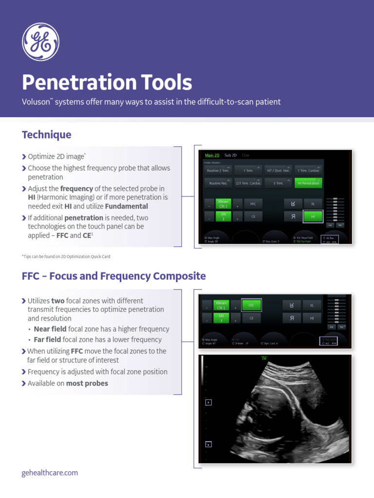 Penetration Tools Quick Card Voluson 2020 | PDF | Technology & Engineering