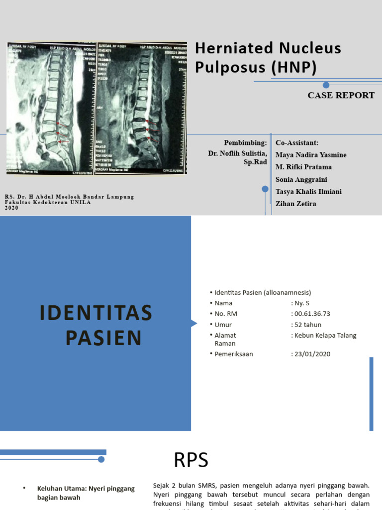 Herniated Nucleus Pulposus - Case Report | PDF | Vertebral Column | Back Pain