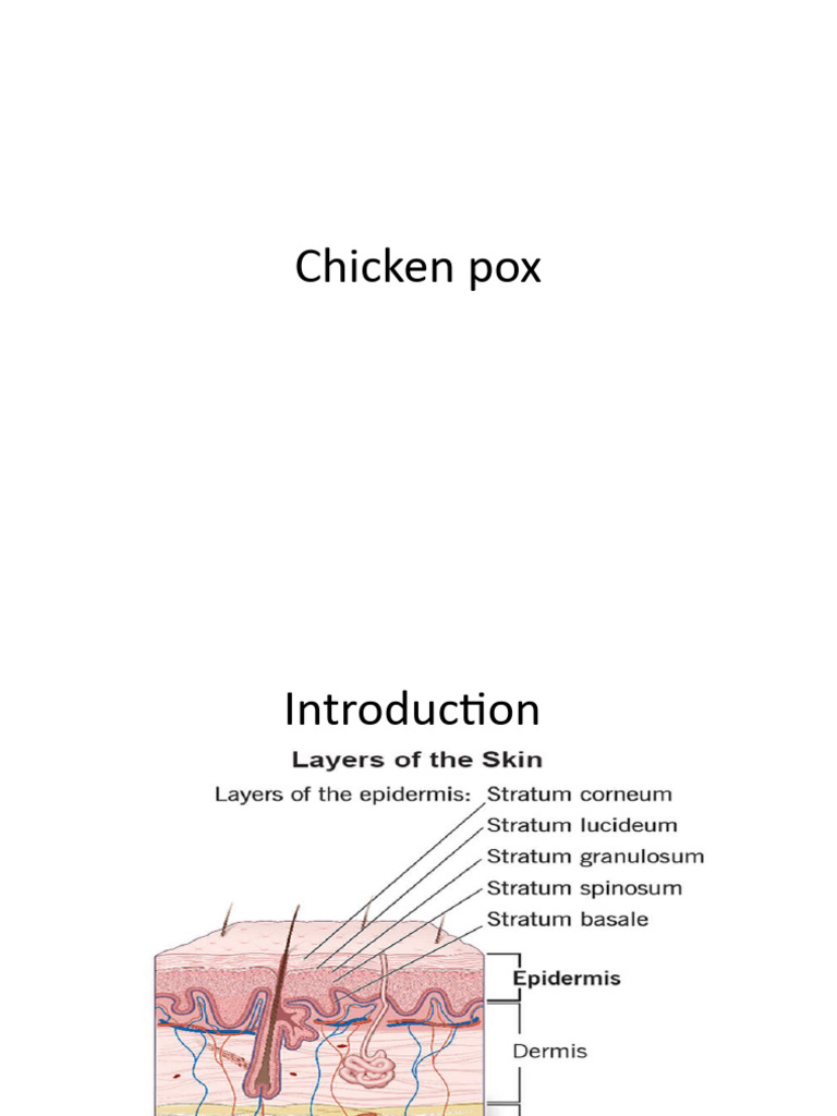 Understanding Chicken Pox: Stages & Treatment | PDF