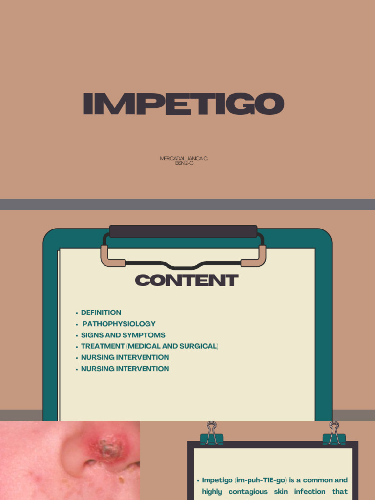 Impetigo | PDF | Medical Specialties | Diseases And Disorders