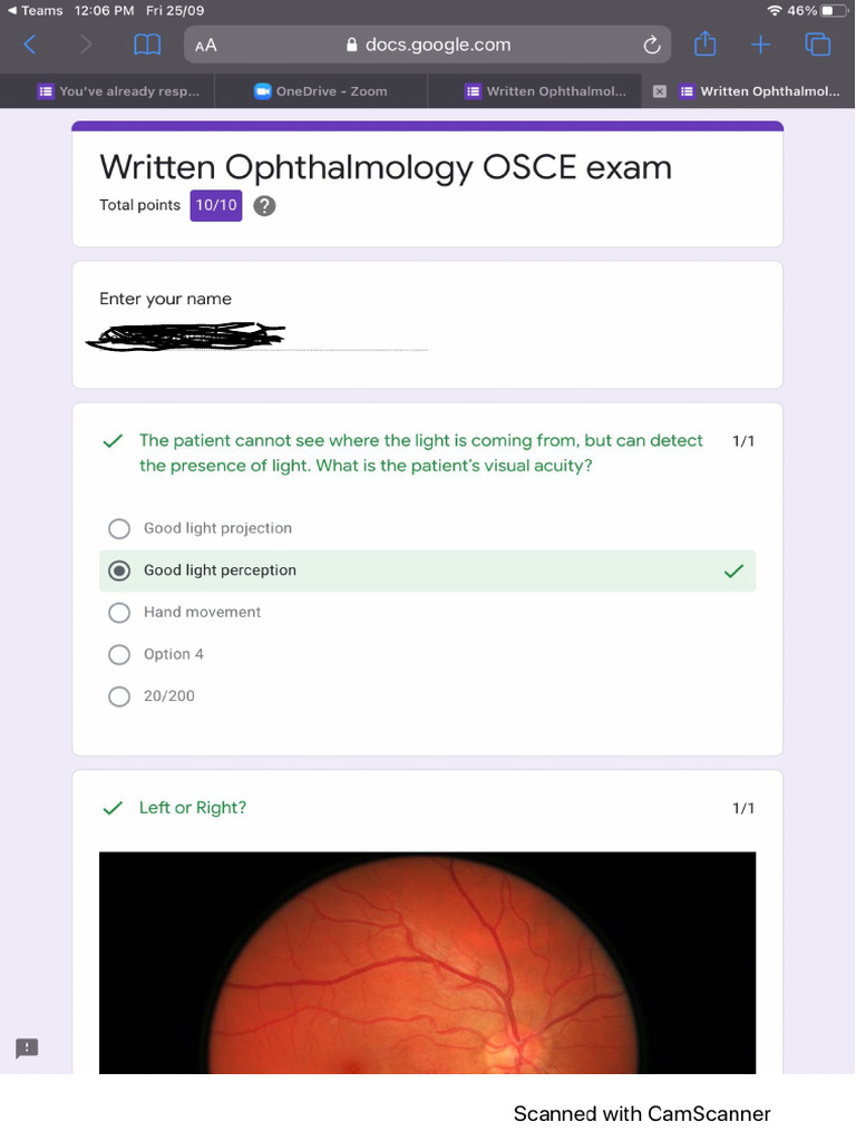 Ophtha OSCE Exam | PDF