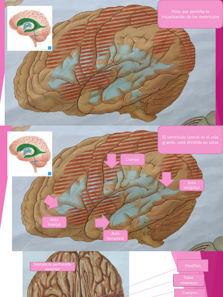 Detalles Anatómicos Tallo Cerebral | PDF | Cerebelo | Neuroanatomía