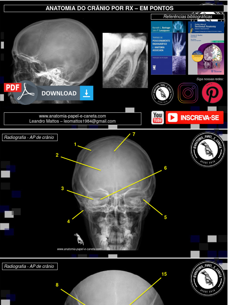 Anatomia Radiológica do Crânio | PDF