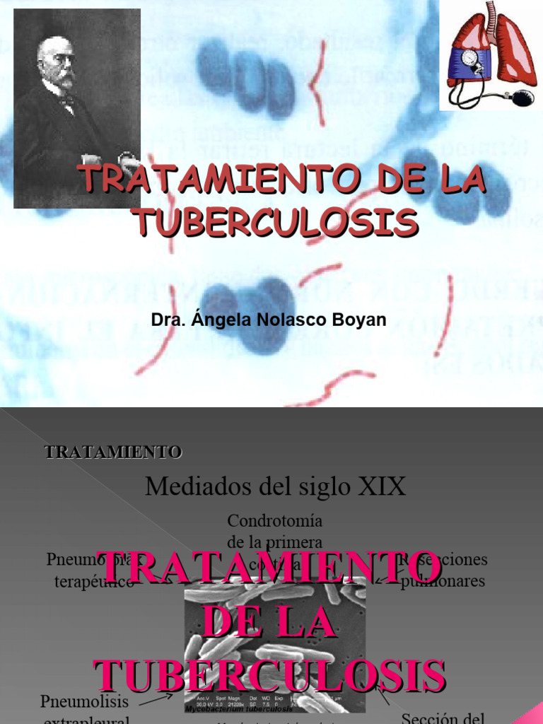 Tratamiento TB U | PDF | Tuberculosis | Medicina CLINICA