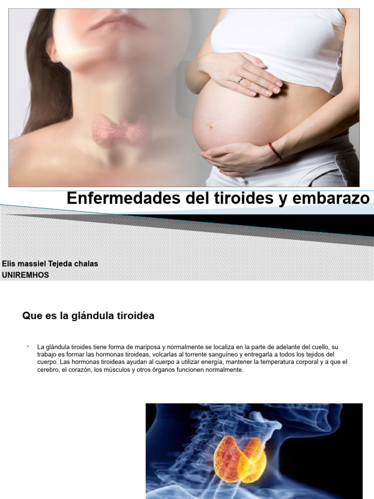 Enfermedades Del Tiroides y Embarazo | PDF | Tiroides | Hipertiroidismo