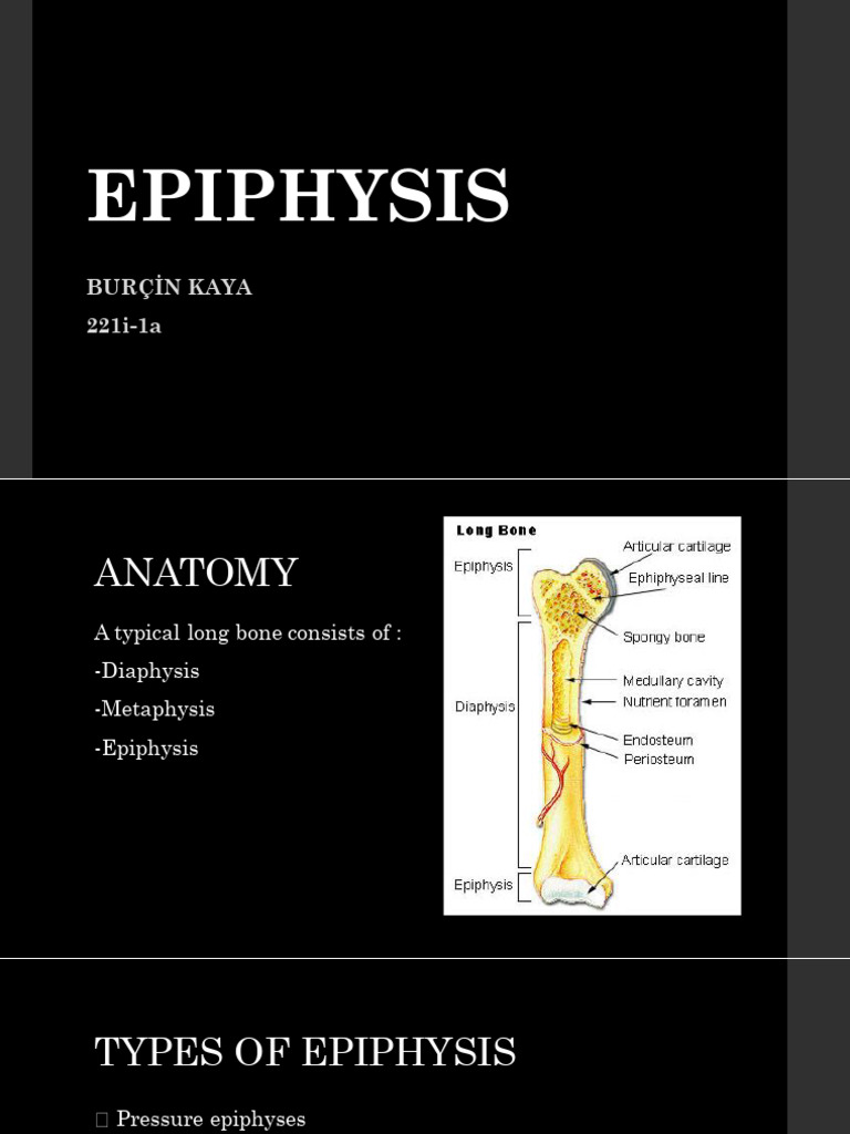 Epiphysis Anatomy and Lesions | PDF | Sports & Recreation | Science ...