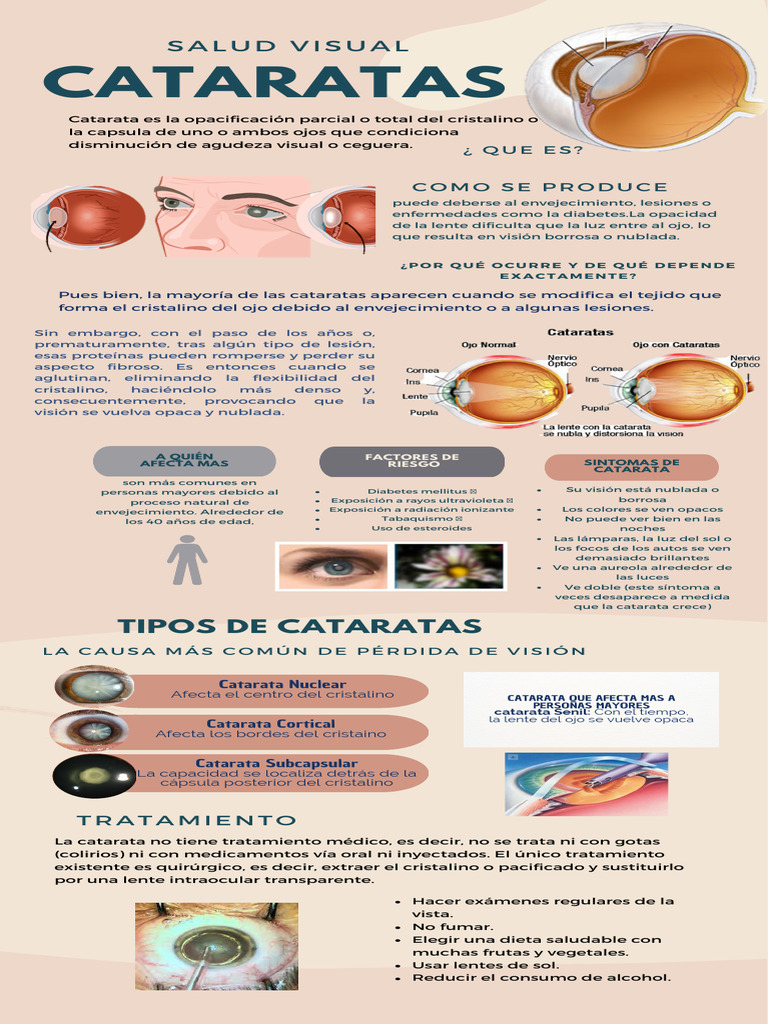 Signos y síntomas de cataratas | PDF | Catarata | Ojo humano