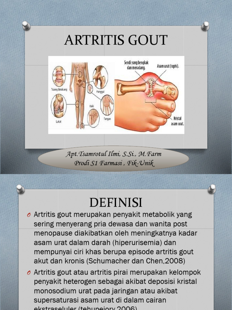 Farmakoterapi Artritis Gout | PDF