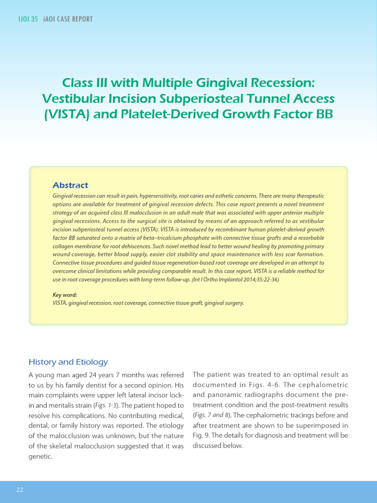 Class III With Multiple Gingival Recession: Vestibular Incision ...