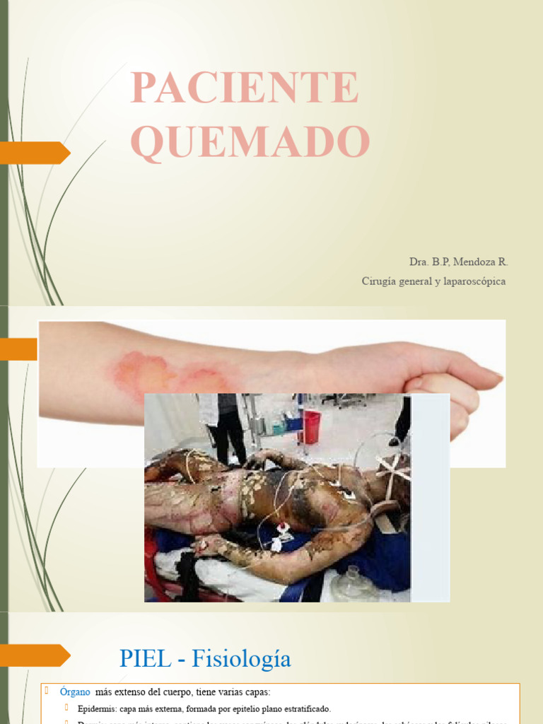 Clasificación y tratamiento de quemaduras | PDF | Quemar ...