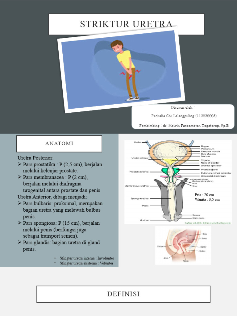 Striktur Uretra | PDF