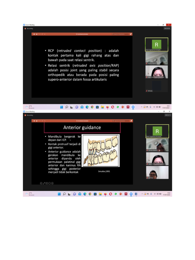 Gangguan Oklusi dan Terapi Mandibula | PDF