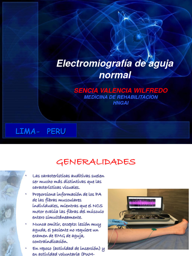 EMG de Aguja Normal | PDF | Electromiografia | Medicina CLINICA