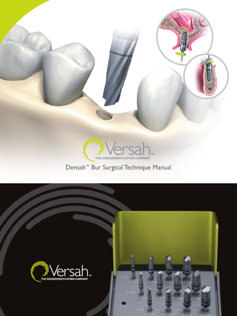 VRSA 0034 Densah Bur Kit Web Manual16 | PDF | Dental Implant ...