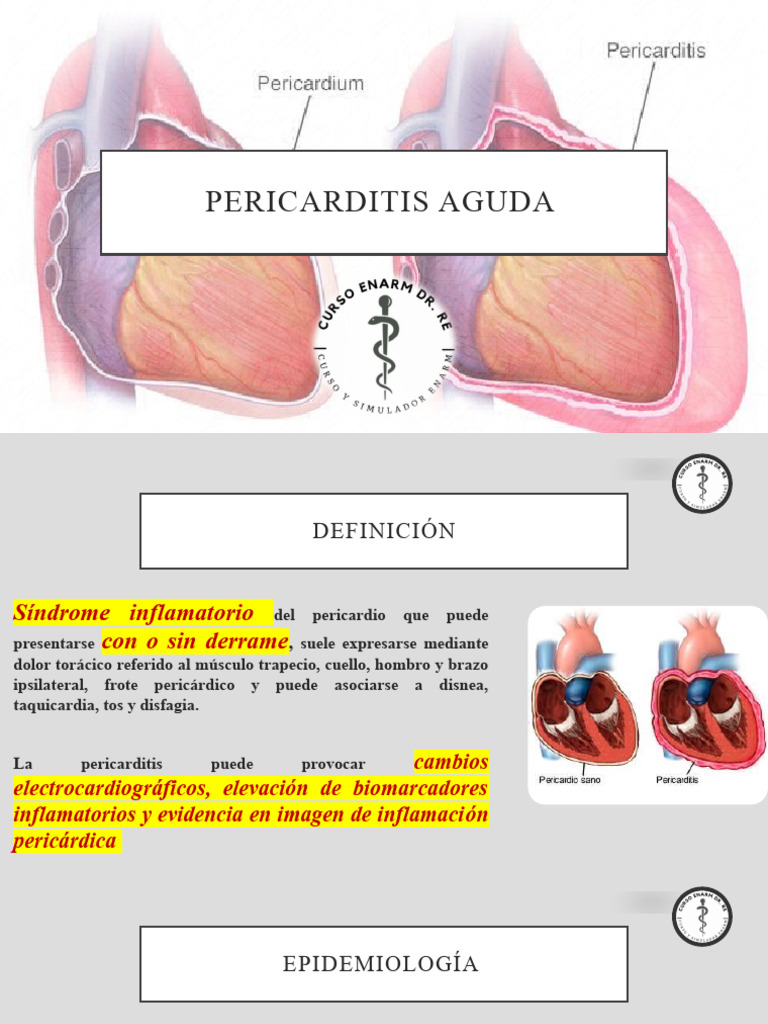 Pericarditis Aguda | PDF | Medicina CLINICA | Enfermedades y trastornos