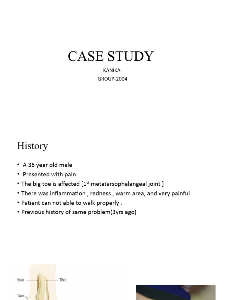 Case Study Kanika | PDF