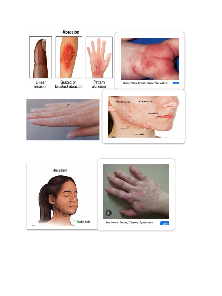 SKIN | PDF