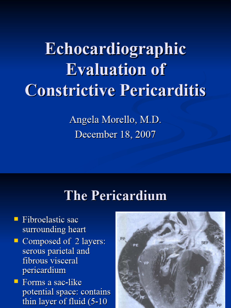 1207 Angela Morello Constrictive Pericarditis | Download Free PDF | Diastole | Heart