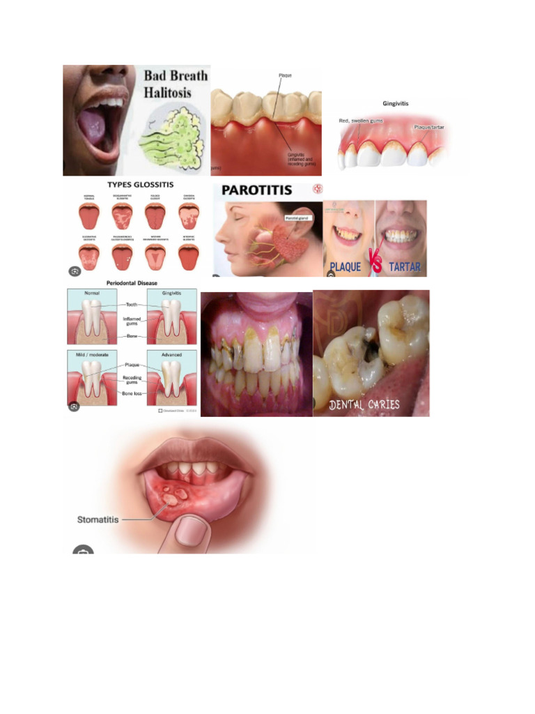 MOUTH | PDF