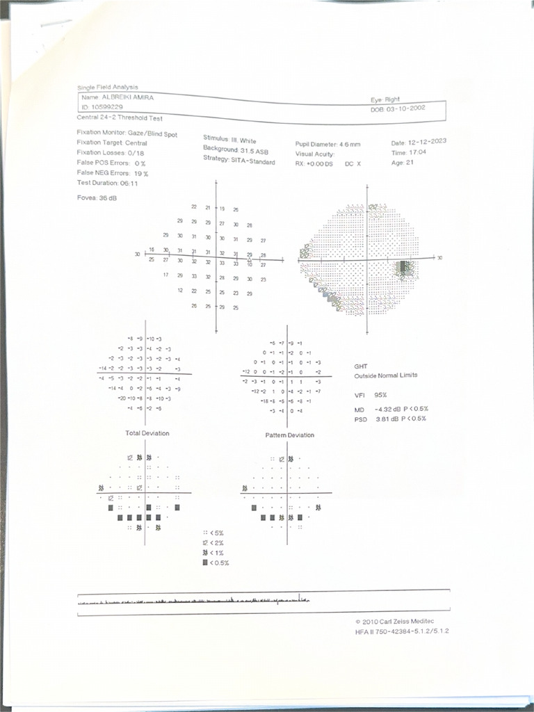 Single Field Analysis 2 | PDF