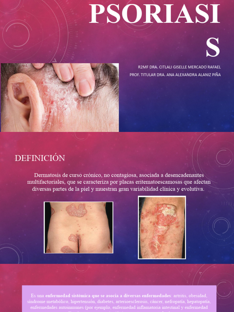 PSORIASIS | PDF | Psoriasis | Enfermedades y trastornos