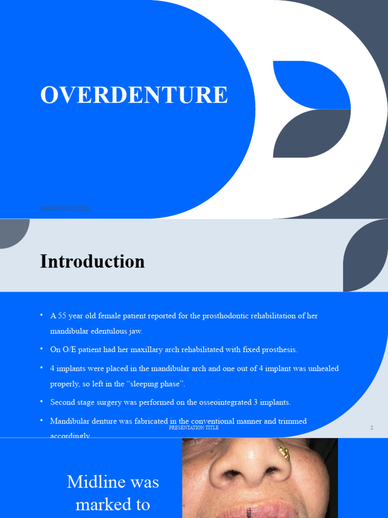Overdenture Case | PDF | Home & Garden