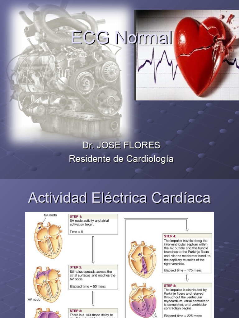 Tipos de ECG y su utilidad clínica | PDF | Electrocardiografia ...