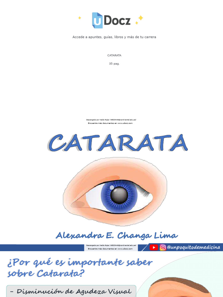 Catarata 111014 Downloadable 116909 | PDF | Catarata | Ojo humano