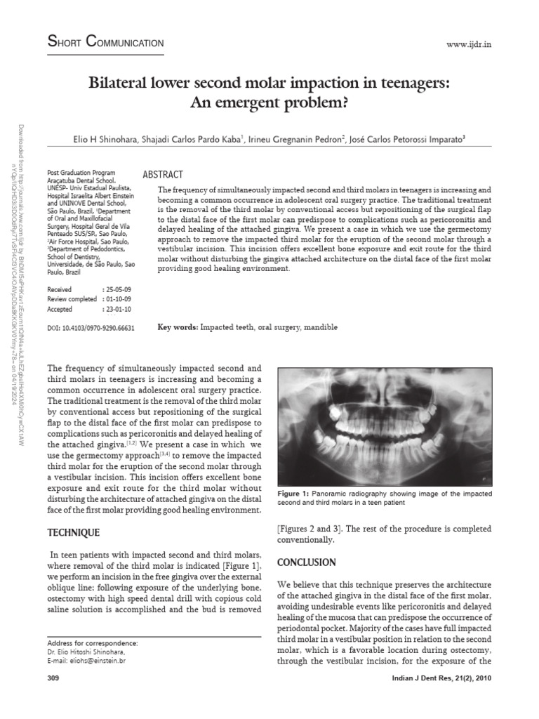 Bilateral Lower Second Molar Impaction in Teenagers | PDF | Oral And ...
