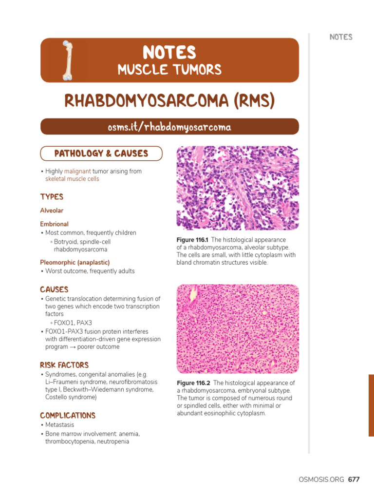 Muscle tumors | PDF | Diseases And Disorders | Human Diseases And Disorders
