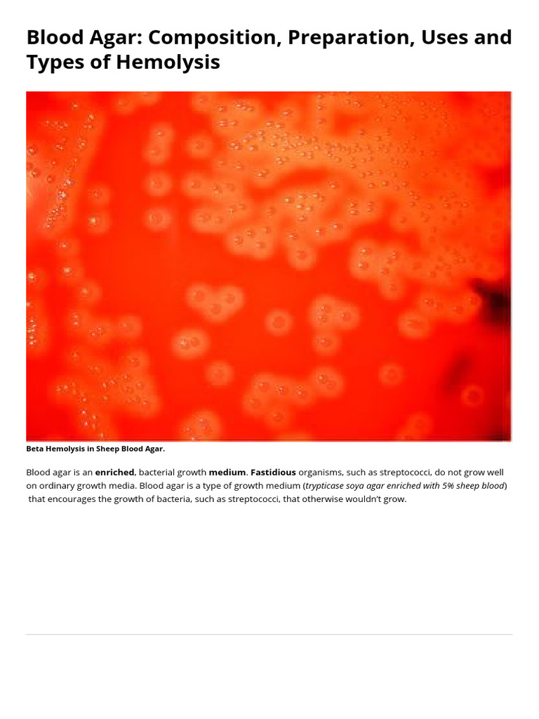 Blood Agar - Composition, Preparation, Uses and Types of Hemolysis ...