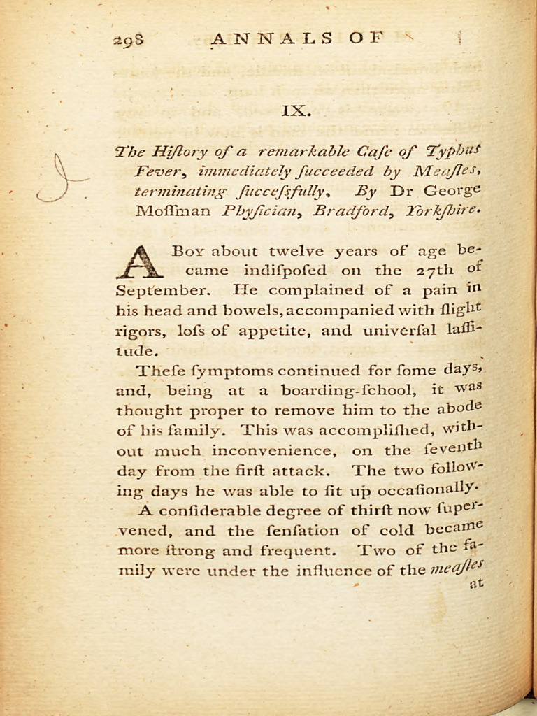 Typhus Fever Succeeded by MeaslesTerminating Successfully | PDF ...