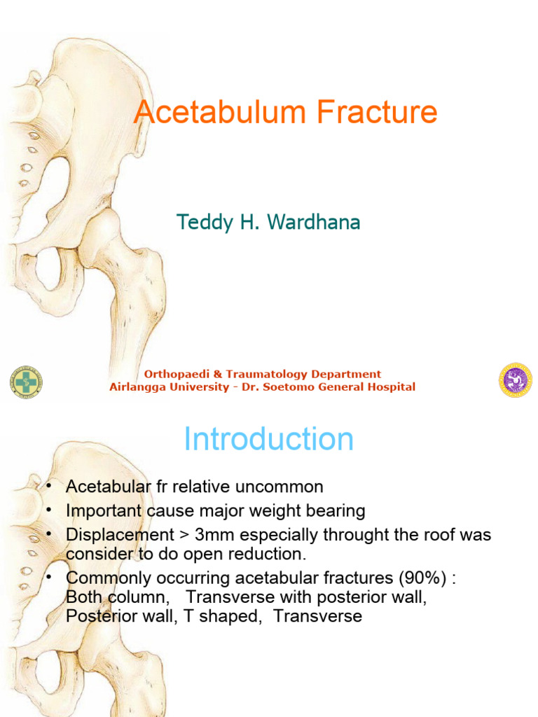 Plating Acetabulum | PDF | Pelvis | Anatomical Terms Of Location