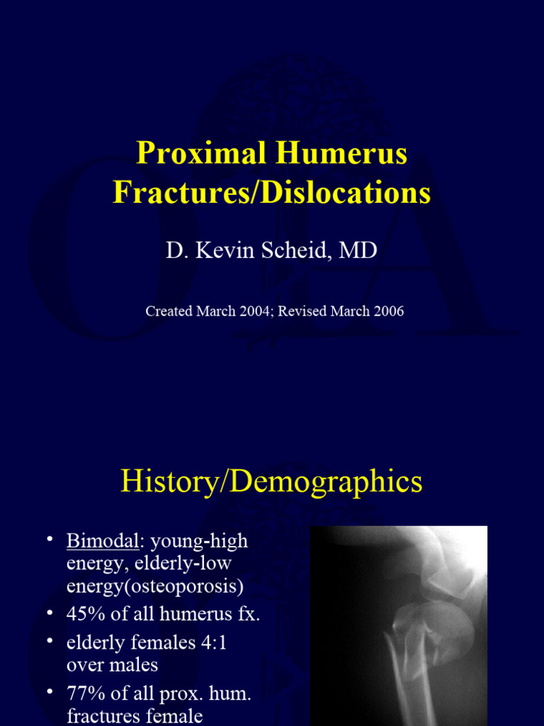 Proximal Humerus Fractures & Dislocations Guide | PDF | Musculoskeletal ...