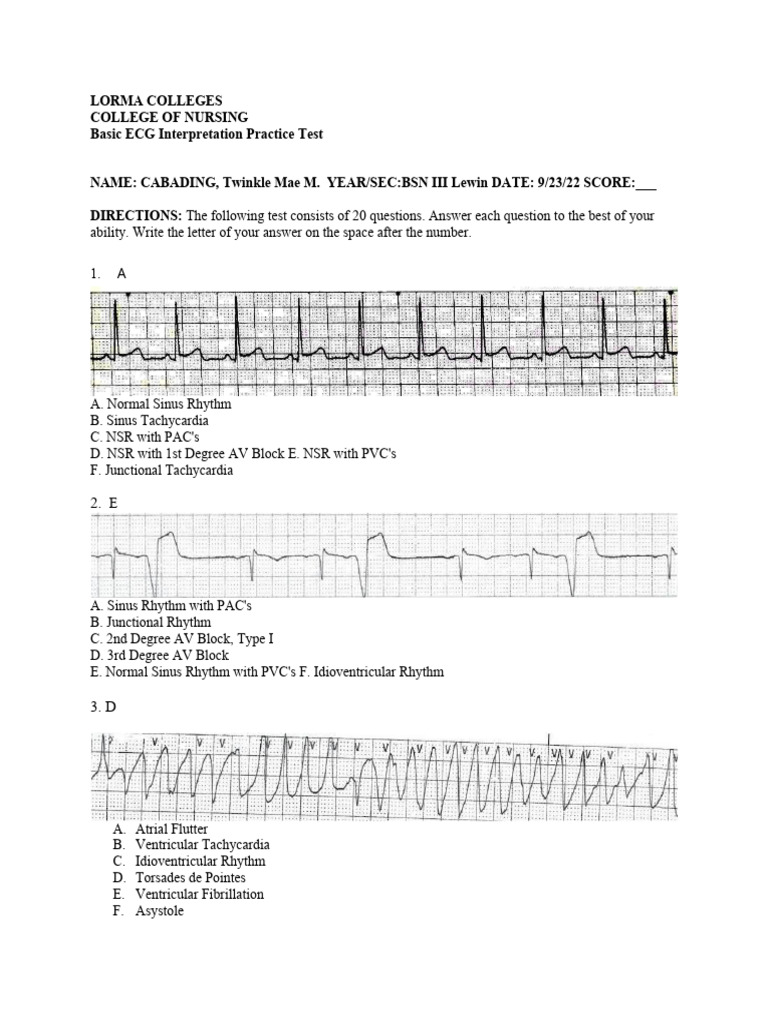 Sept 17 ECG Interpretation | PDF | Cardiovascular System ...