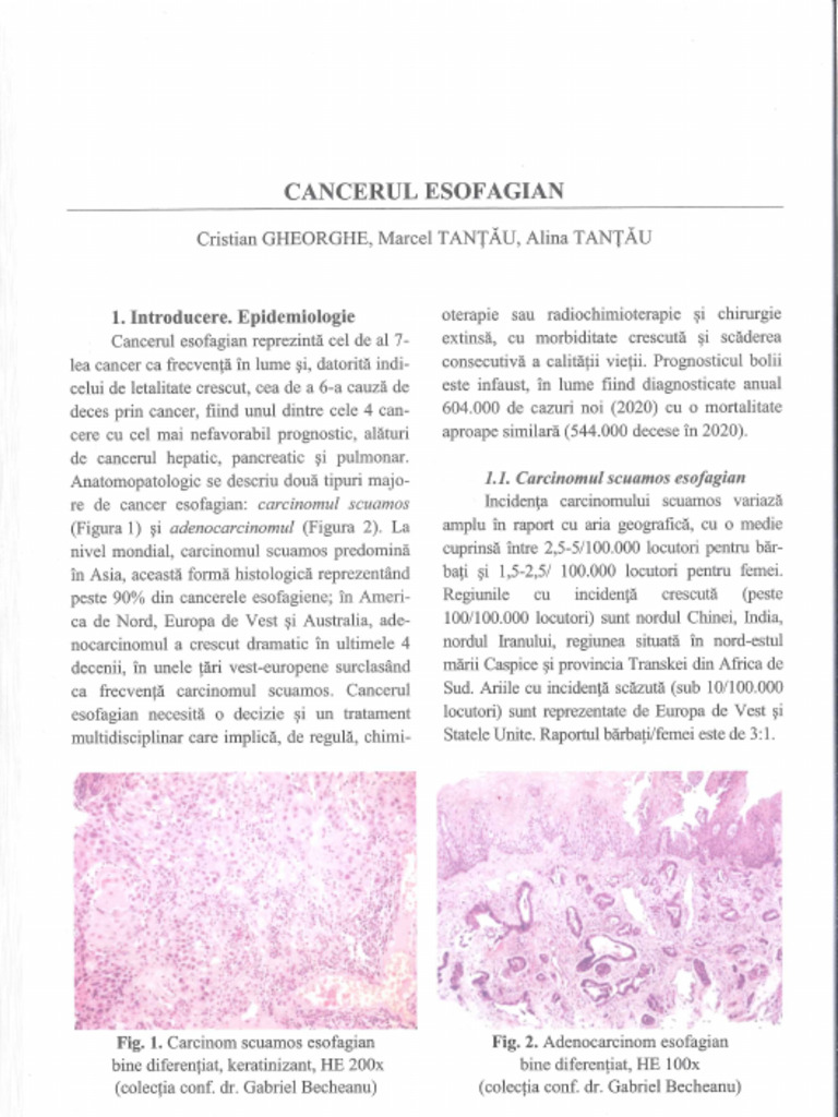 09-Cancerul Esofagian | PDF