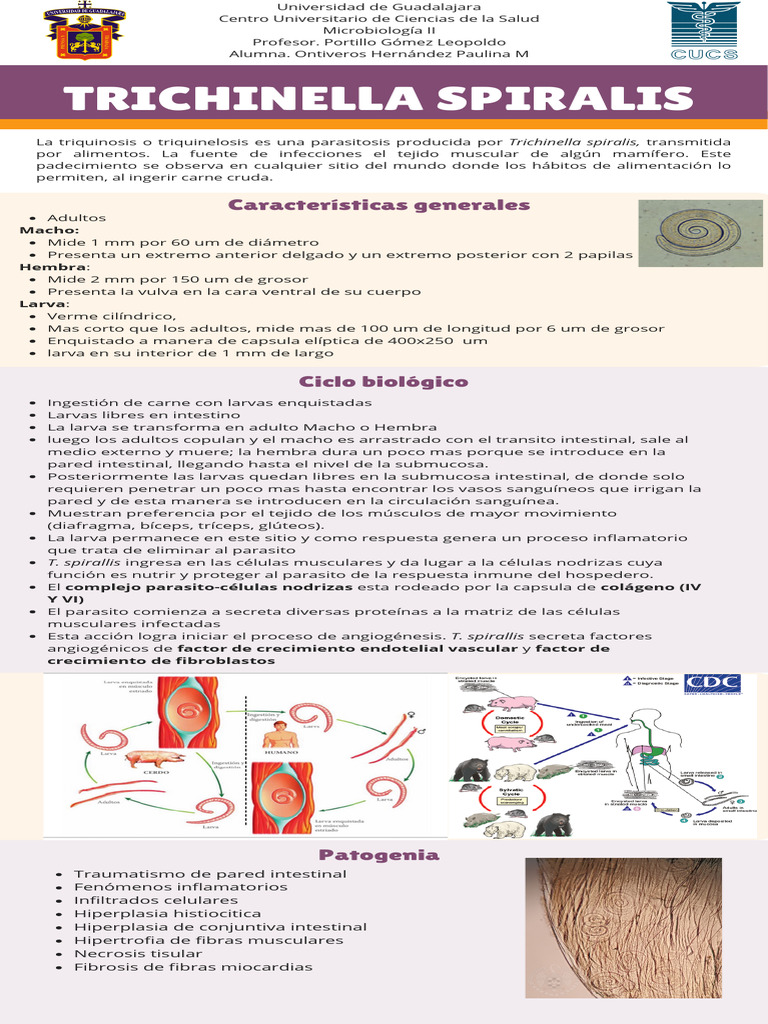 Trichinella Spiralis | PDF | Causas de la muerte | Medicina CLINICA