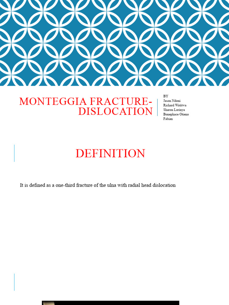 Monteggia Fracture-Dislocation | PDF | Science & Mathematics
