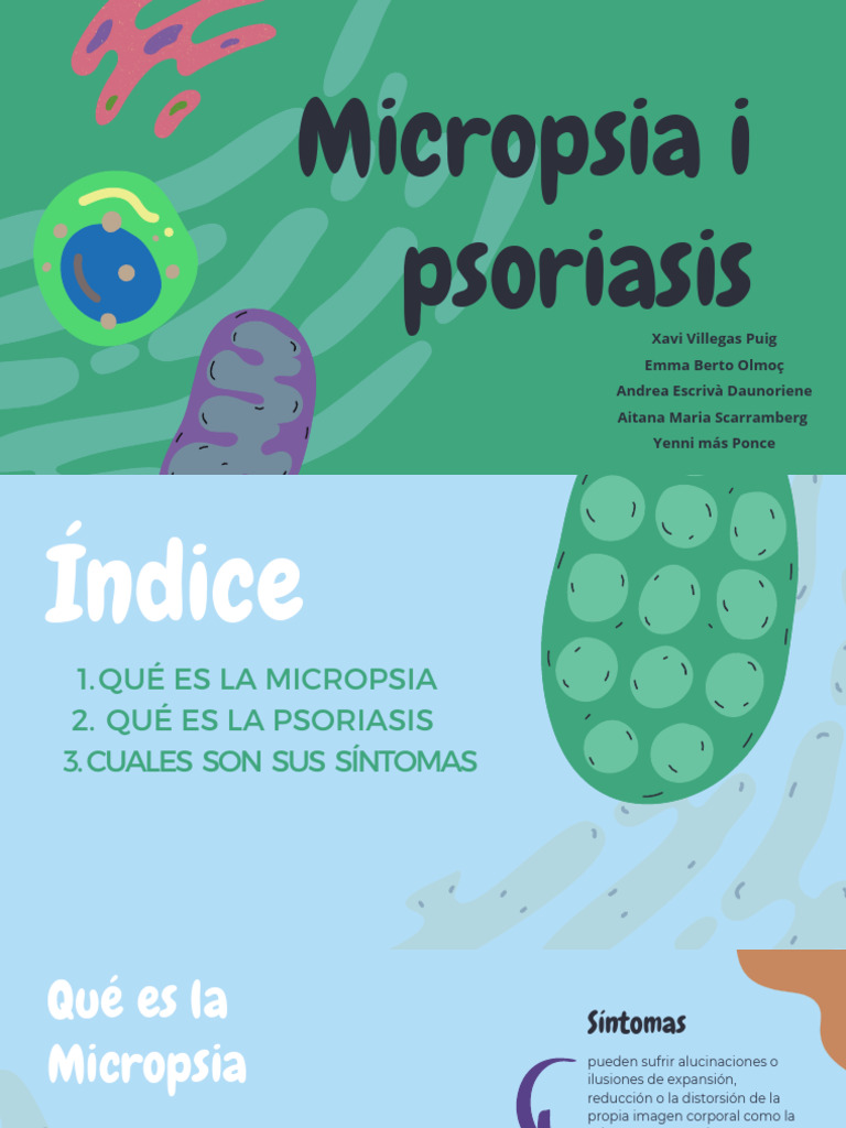 Micropsia y Psoriasis: Síntomas y Tratamientos | PDF | Medicina CLINICA ...