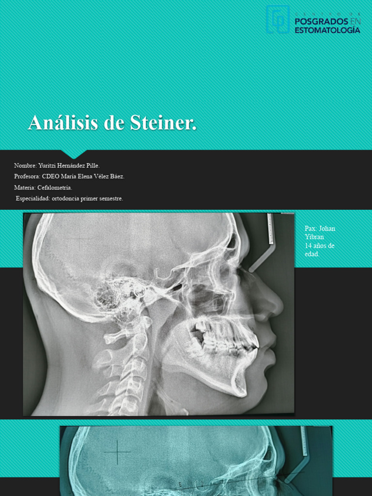 Análisis de Steiner | Descargar gratis PDF | Anatomía humana